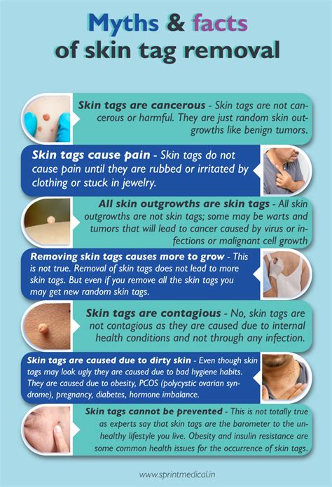 Skin Tags On Neck Removal