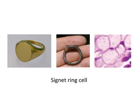 Ppt Overview Of Upper Gastrointestinal Pathology Powerpoint