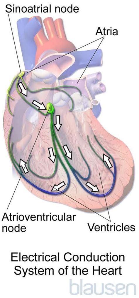 Fakta Singkat Atrial Fibrilasi Dan Atrial Flutter Manual Msd Versi Konsumen