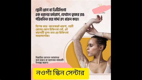 Skinsexallergy And Hairfall Specialist Noagaonfor Serial