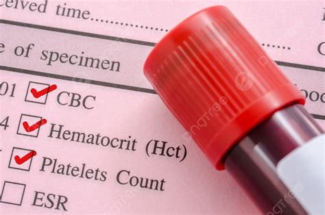Screening Test Requesting Cbc Hematocrit And Platelet Count Photo