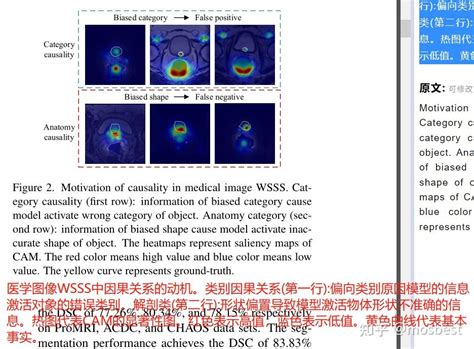 Cvpr C Cam Causal Cam For Weakly Supervised Semantic Segmentation On Medical Image 知乎