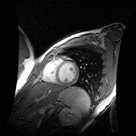 Figure 2 From A Simulated Annealing Based Optimal Threshold Determining Method In Edge Based