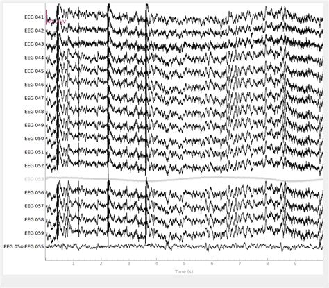 Setting The EEG Reference MNE Documentation