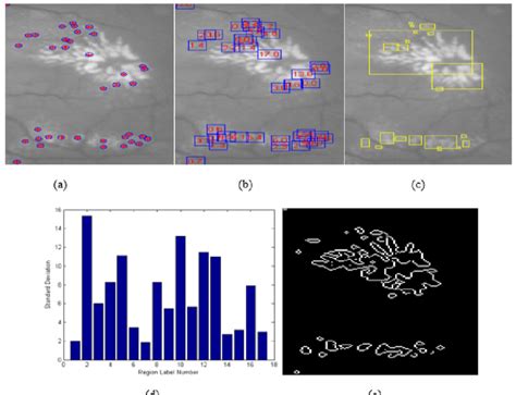 Results Of Drusen Detection A Weighted Centroid Of Components B Download Scientific