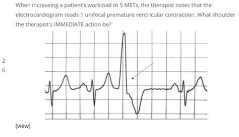 Missed Npte Questions And Concepts Flashcards Quizlet