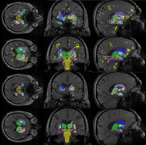Visual Comparison Of Semantic Segmentation Results Top Two Rows And