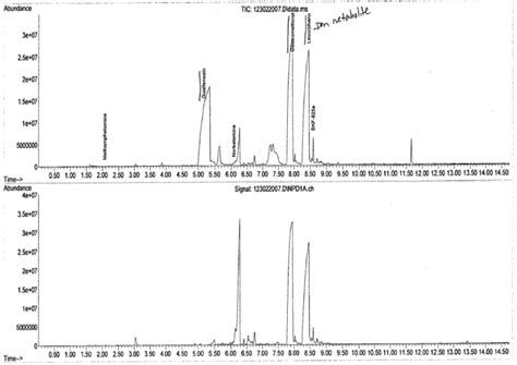 Bilateral Nephrolithiasis Following Ingestion Of Guaifenesin And Dextromethorphan Pmc