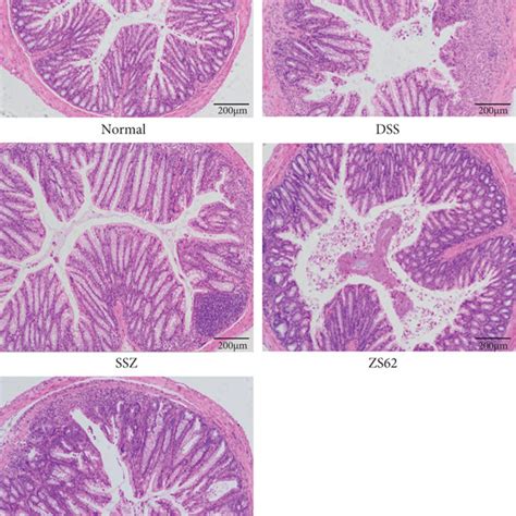 Colon Length Cm Of Experimental Mice A Average Length Of Download Scientific Diagram