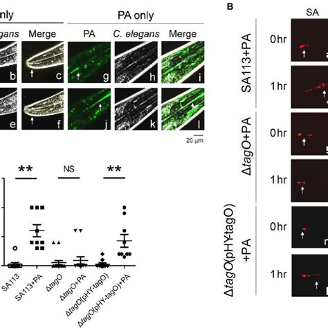 Influence Of Wta In The Hitchhiking Motility Of Staphylococcus Aureus