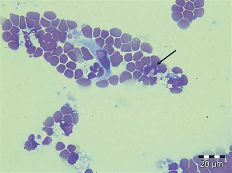 Peripheral Blood Smear Taken During The Boerboel Necropsy Showing