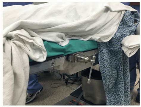 Principles Of Operative Positioning Abdominal Key