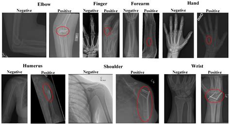 Diagnostics Free Full Text A Pyramid Deep Feature Extraction Model