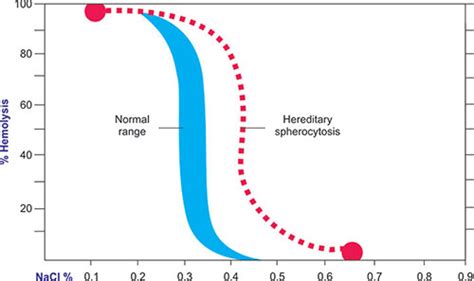 What Is The Osmotic Fragility Test The Blood Project