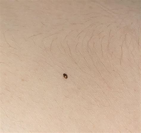 What Does This Bug Look Like R Whatsthisbug