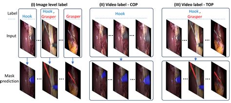 Self Supervised Video Desmoking For Laparoscopic Surgery Ai Research Paper Details