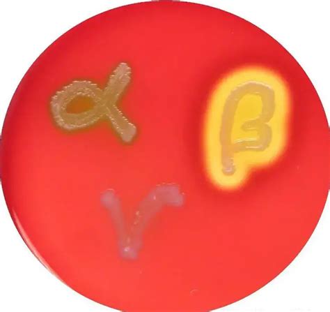 Difference Between Alpha Beta And Gamma Hemolysis Relationship Between