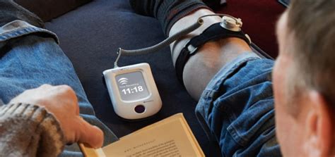 Ready To Prescribe Exogen Exogen Ultrasound Bone Healing System