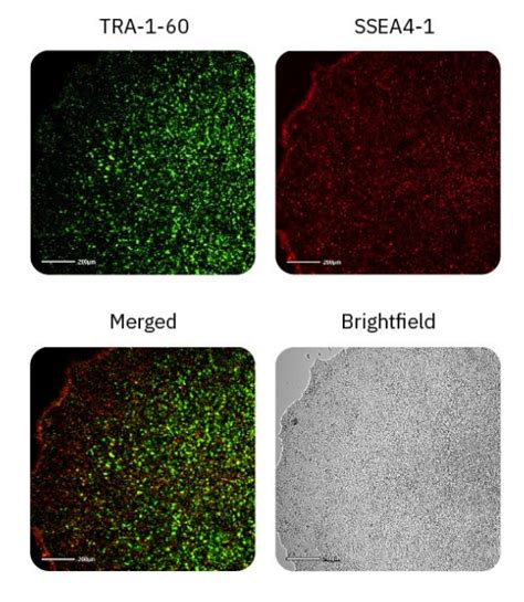 Automated Real Time Monitoring Of Stem Cell Cultures Axion Biosystems