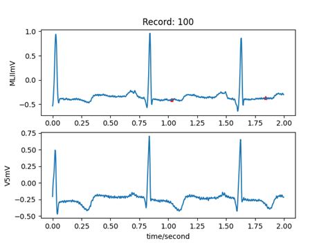 Plot Wfdb Times Don T Math For Annotation And Record Issue MIT LCP Wfdb Python GitHub