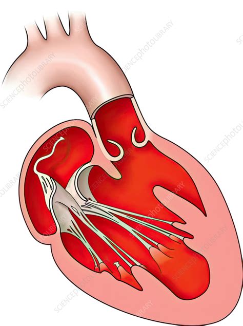 Hypoplastic Left Heart Syndrome Illustration Stock Image C0593299 Science Photo Library