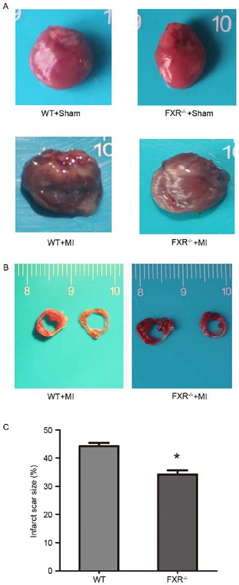 Cardiac Structure And Function In Mice Following Mi A Representative Download Scientific