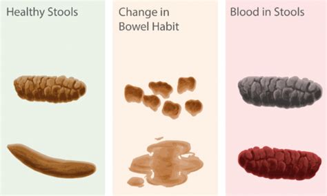 Stool Chart Blood At Kay Sellers Blog