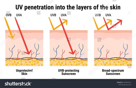 Uv Penetration Into Layers Skin Infographic Stock Vector Royalty Free Shutterstock