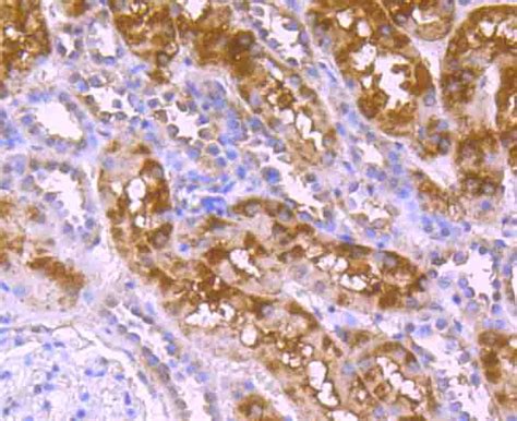 Cd130 Gp130 Mouse Monoclonal Antibody B11 B9 A8 Em1701 43 Huabio