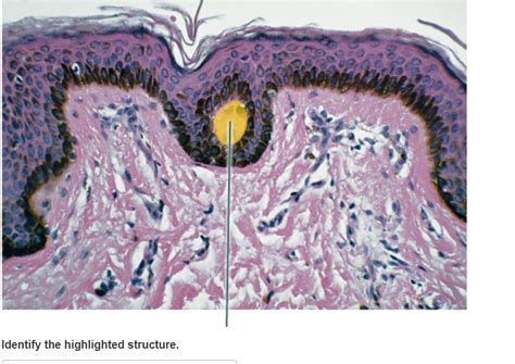 Solved Identify The Highlighted Structure