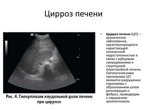 Лучевая диагностика печени поджелудочной железы желчного пузыря презентация онлайн