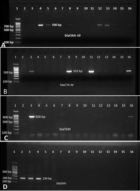 Diversity Of Extended Spectrum β Lactamases Among Multi Drug Resistant Clinical Isolates Of