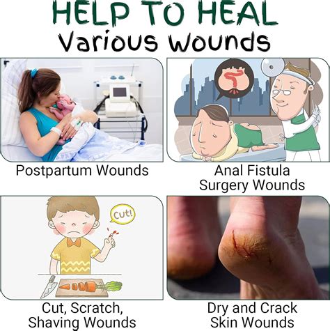 Lmnoop® Perianal Care Cream Fast Healing Wounds For Anus Fissure