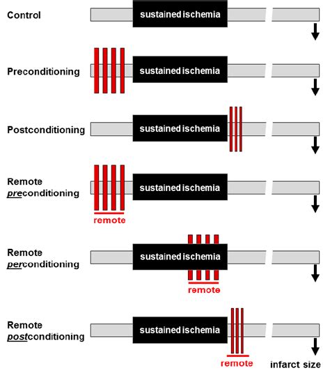 Schematic Diagram Illustrating The Key Temporal Aspects Of Download Scientific Diagram