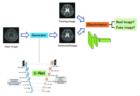 A Generative Adversarial Network Gan Framework Given An Input Mri