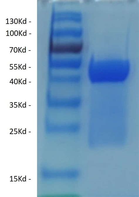 2019 Ncov Nucleocapsid Exonbio