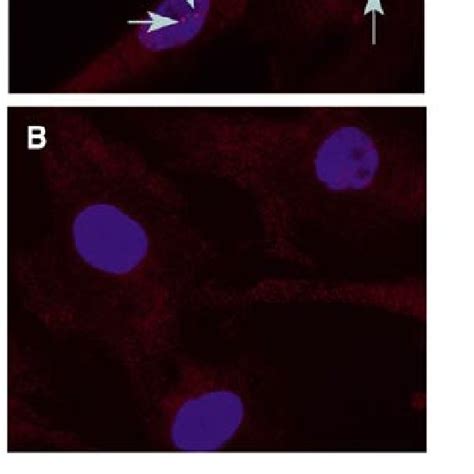 Smn Protein Expression In Aclarubicin Treated Sma I Fibroblasts 3813 Download Scientific