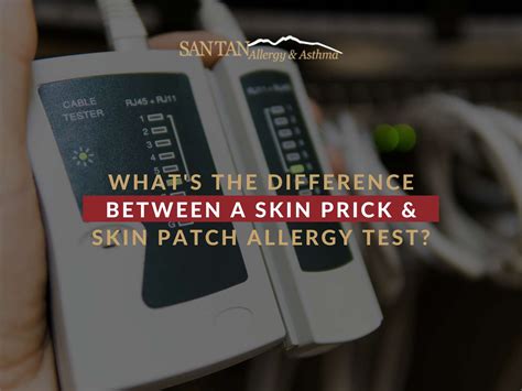 The Difference Between A Skin Prick And Skin Patch Allergy Test