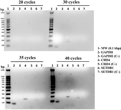 Figure 1 From Evidence Of A Synthetic Lethality Interaction Between