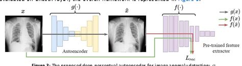 Figure From Review On Deep Learning Methods For Chest X Ray Based Abnormality Detection And