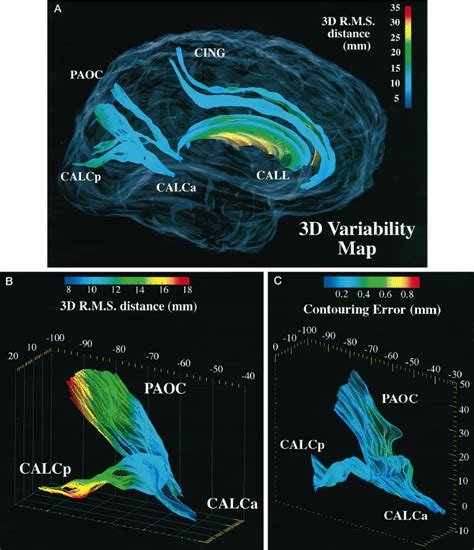 A Average Surface Representations And 3d Variability Maps For Major Download Scientific