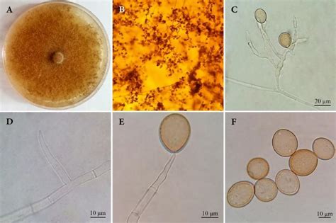 Harzia Acremonioides Isolate Ha 1 Iran 2839c Ab Colony And