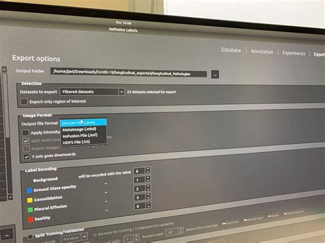 Export Output File Format No Nifti Available Imfusion Labels