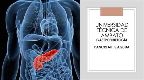 Pancreatitis Aguda Lady Elizabeth Udocz Pancreatitis Aguda Lady Elizabeth Udocz