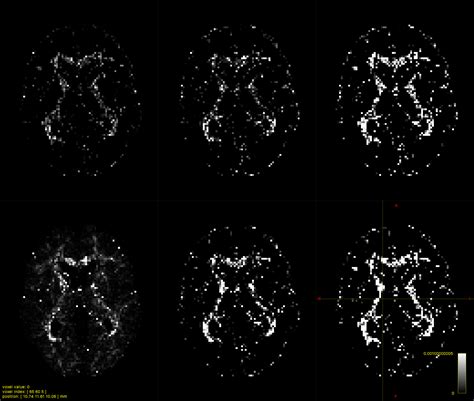Constrained Estimation Of The Diffusion Kurtosis Tensor And Kurtosis