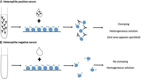 Monospot Test Principle Procedure Uses • Microbe Online
