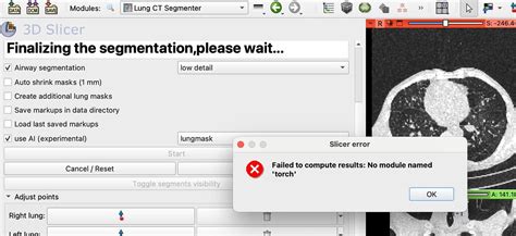 Lung Ct Segmenter Now Supports Lungmask Ai For Lung And Lobe Segmentation Support 3d