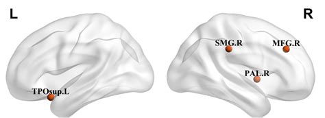 Figure 1 From Altered Structural Brain Network Topology In Patients