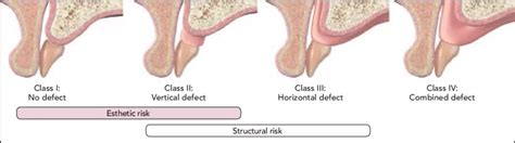 The Ltr Classification Visual Representation Of The Four Major