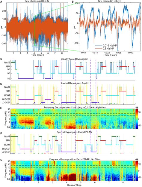 figure 6 from validation of spectral sleep scoring with polysomnography